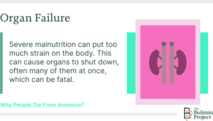 Anorexia Mortality Rates | The Bulimia Project